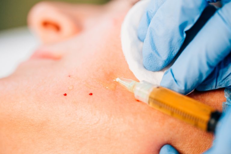 How NeoGen Plasma Works | Skin and Tonic